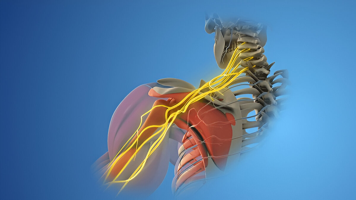 What is Brachial Plexus? Causes, Symptoms & Treatment | EOS